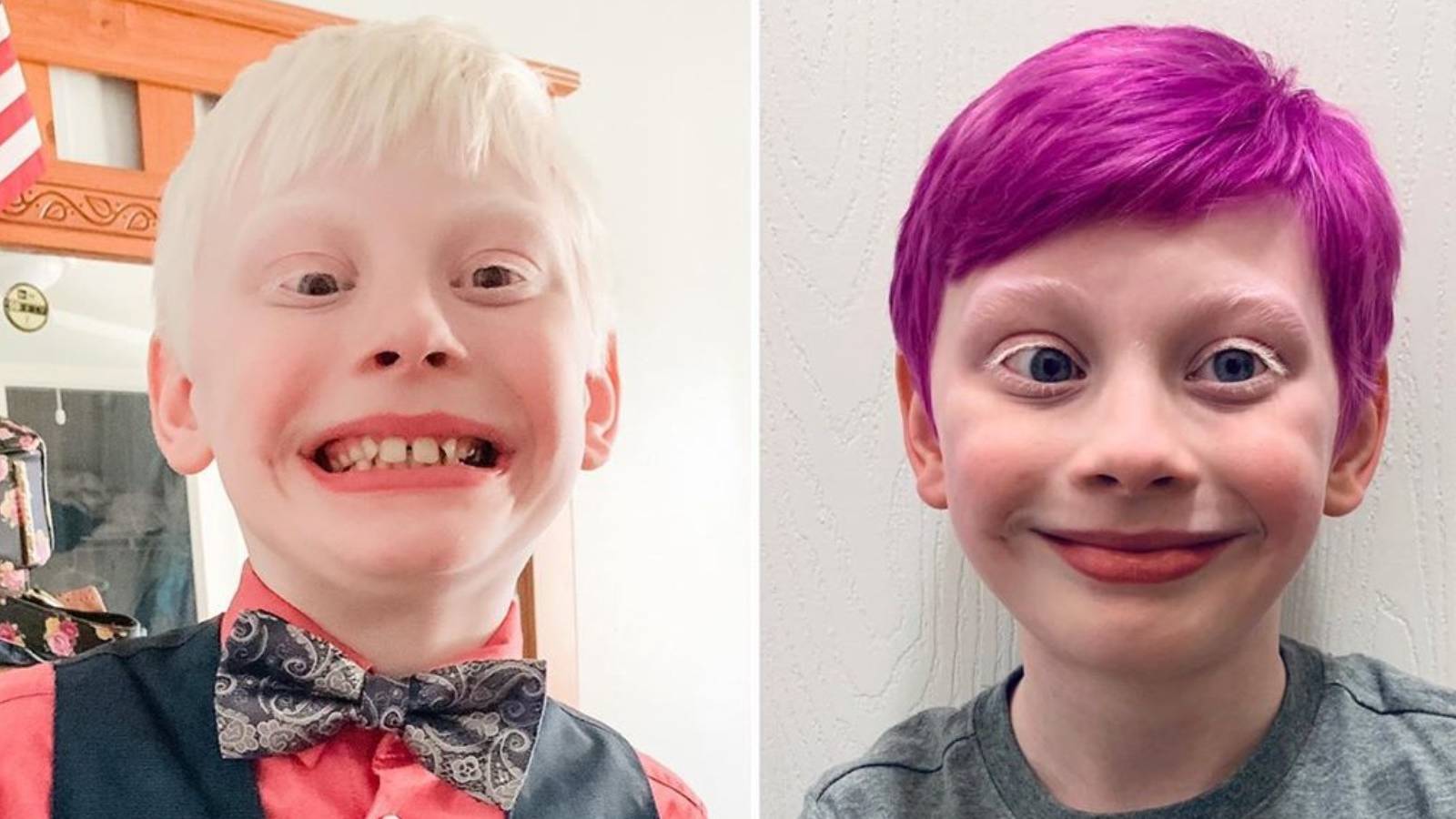 Timothy Hasty Dyes Hair Purple